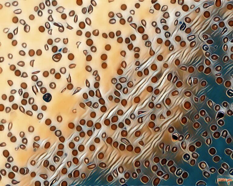 Red Cell Indices - MCV, MCH & MCHC | Laboratory Hub